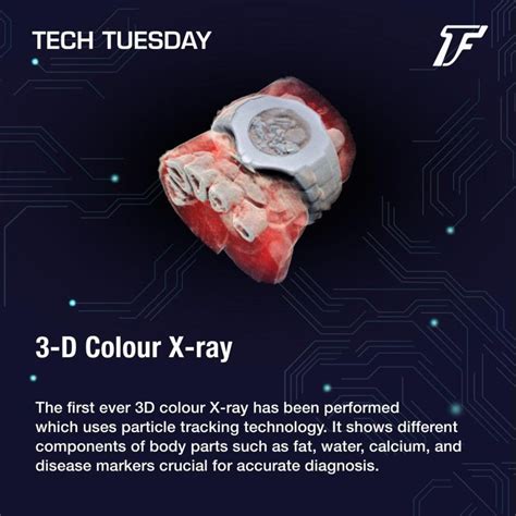 In This Weeks Techtuesday Techfest Iit Bombay Brings You A