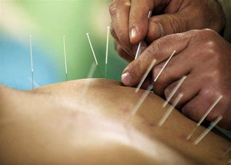 Trigger Point Dry Needling Back To Motion Denver Physical Therapy