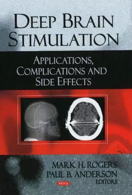 Deep Brain Stimulation Applications Complications And Side Effects By Paul B An Eur 13488