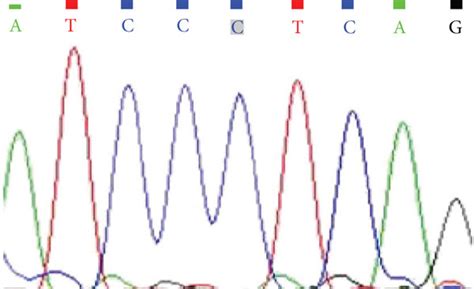 Electropherogram Analysis Showing The Sequencing Results For Two Tgfb1