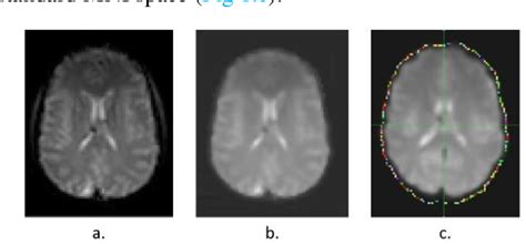Figure 1 From Gcn Analysis Of Task Based Fmri Data For Diagnosis Of