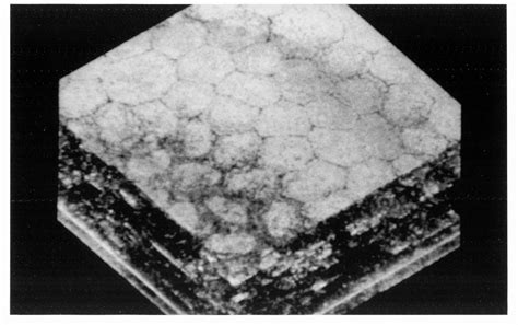 Figure 3 From Scanning Microscopy Scanning Microscopy Confocal