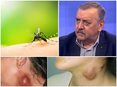 ЗАПЛАХА Проф Кантарджиев бие тревога Опасно заболяване от миналото отново е тук