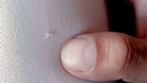 7 Tiny Bugs On Couch That Are Not Bed Bugs