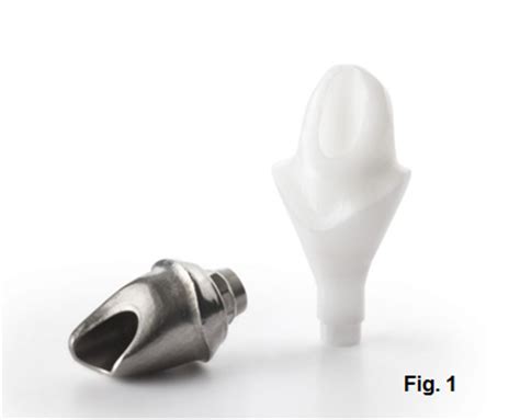 Implants Custom Abutment Choices Spear Education