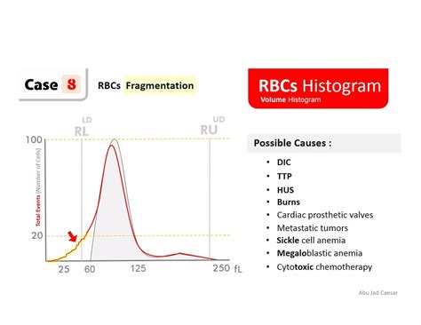 Rbc Histogram Pdf