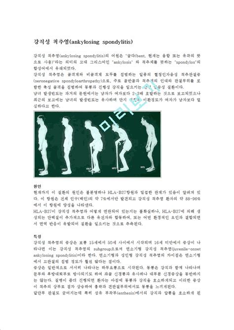 강직성 척추염 올레포트