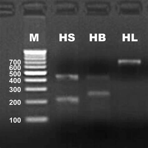 Molecular Differentation Of Hypoderma Spp By Pcrrflp M Marker 100