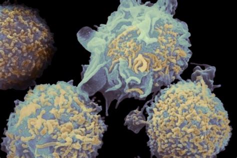 Bone Marrow Structure Function Diseases And More