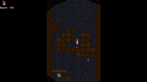 Ixgl1zm Imgur Steven Splint