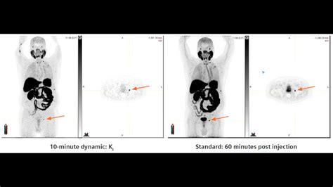 Exploring New Research Avenues Siemens Healthineers