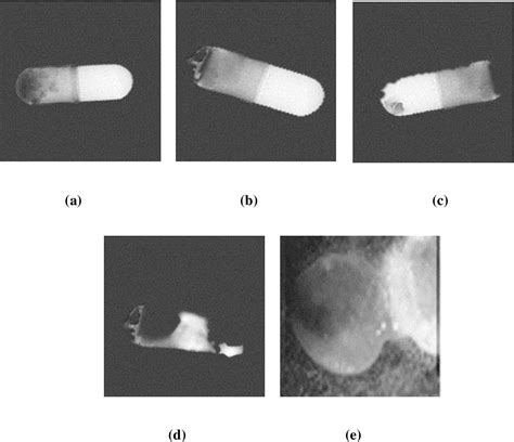 Figure 5 From Formulation And Evaluation Of Colon Specific Drug Delivery System Of Celecoxib