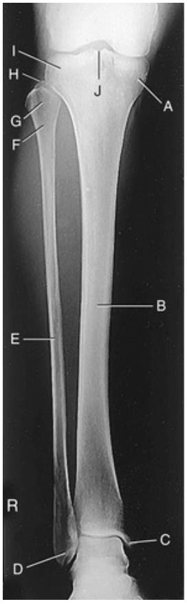 AP Right Tibia And Fibula Diagram Quizlet AP Right Tibia And Fibula Diagram Quizlet