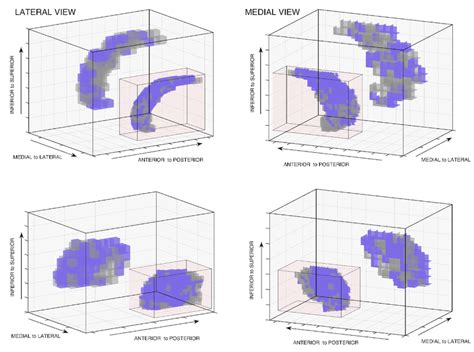 Main Boxes Show 3d Voxel Space Representation Of Left Hemisphere