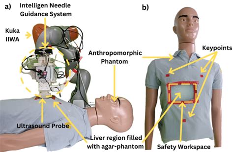 [论文审查] Preliminary Evaluation Of An Ultrasound Guided Robotic System For Autonomous Percutaneous