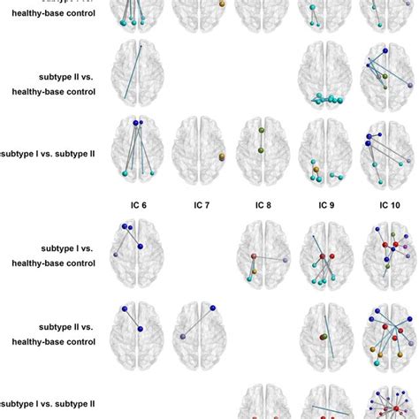 The Group Differences In Functional Connectivity In The Informative Ics Download Scientific