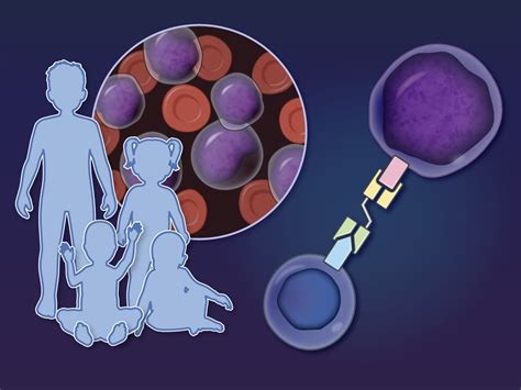 Blinatumomab In B Cell Acute Lymphoblastic Leukemia New England
