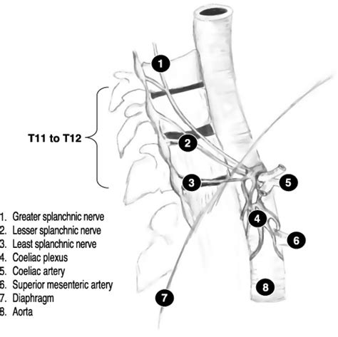 Fluoroscopic Guided Celiac Plexus Splanchnic Nerve Block Technique And Overview The