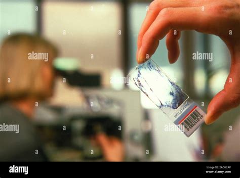 Cervical Smear Slide Hand Holding A Stained Cervical Smear Slide Which Is To Be Examined Under