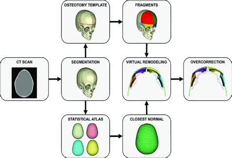 Proposed Workflow For Automatic Surgical Planning Of Foa Download