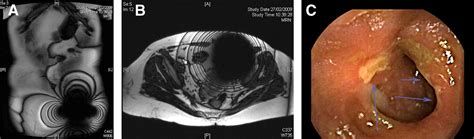 An Urgent Call To The Magnetic Resonance Scanner Potential Dangers Of