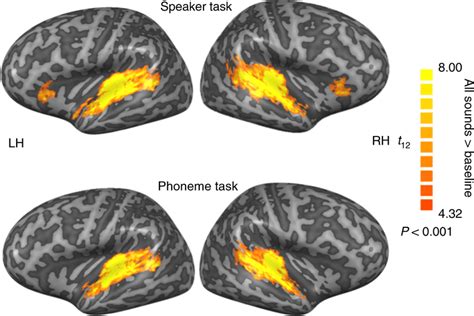 Activations Evoked By Speech Sounds During The Speaker And Phoneme
