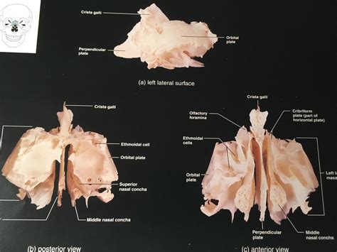 Ethmoid Diagram Quizlet