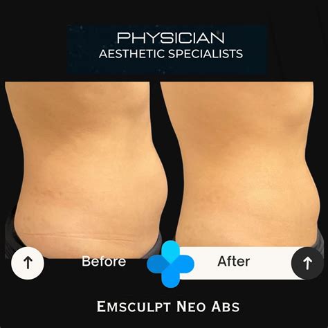 Before After Archive Physician Aesthetic Specialists