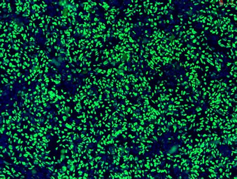 Human Induced Pluripotent Stem Cell Derived Neural Crest Cells