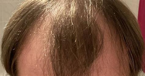 Imgur The Magic Of The Internet