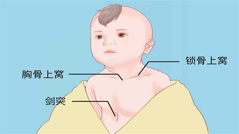 新生儿 喉咙 喉咙凹陷 剑突 医疗图片素材 高清图片素材