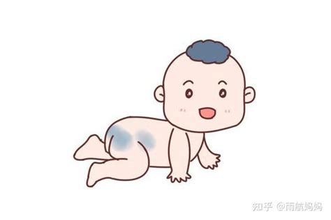 新生儿蒙古斑：原因、科普和注意事项 知乎