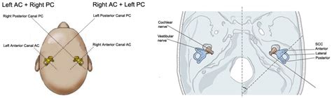 Semicircular Canals Size The Functional Significance Of Semicircular