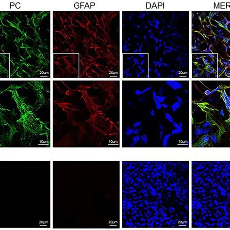 The Presence Of Pyruvate Carboxylase In Glioblastoma The Pyruvate Download Scientific Diagram