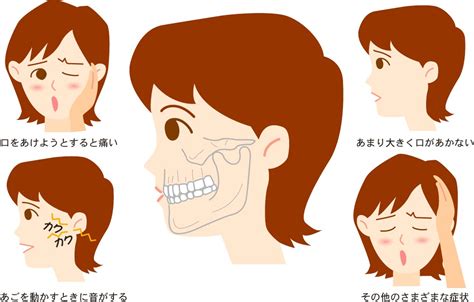 アゴの痛み（顎関節症）