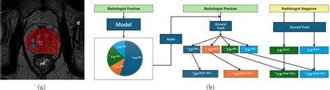 [논문 리뷰] ai assisted prostate cancer detection and localisation on