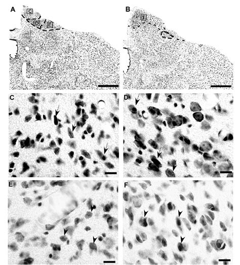 Posterior Pretectal Nucleus Semantic Scholar