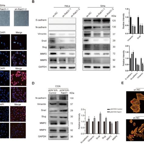 Rab31 Promotes The Migration And Invasion Via Emt And Cytoskeletal Download Scientific Diagram