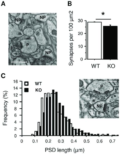 Dp71 Loss Affects Density And Morphology Of Axospinous Asymmetric Download Scientific Diagram