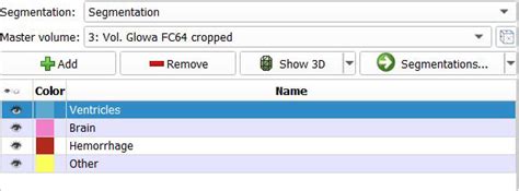 The Creation Of Empty Segments Download Scientific Diagram