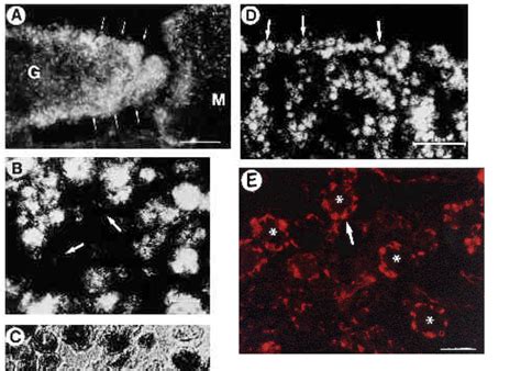 Wt1 Expression In The Ovary Immunofluorescence Shows Nuclear Staining