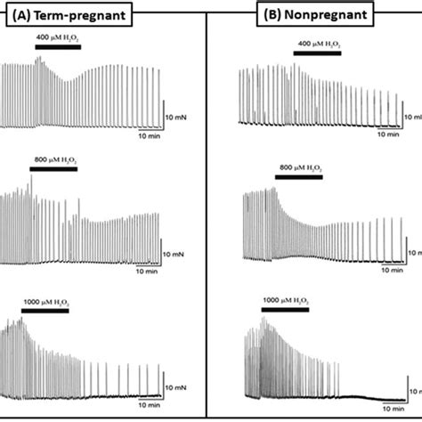 Original Recordings Showing The Contractile Responses Of Uterine Strips