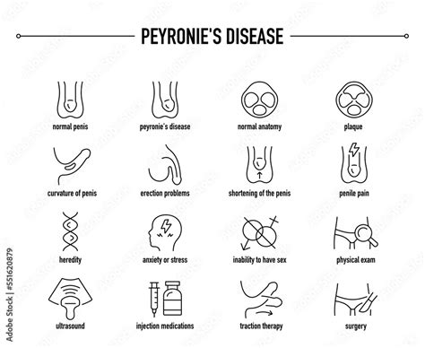 Peyronies Disease Symptoms Diagnostic And Treatment Vector Icon Set