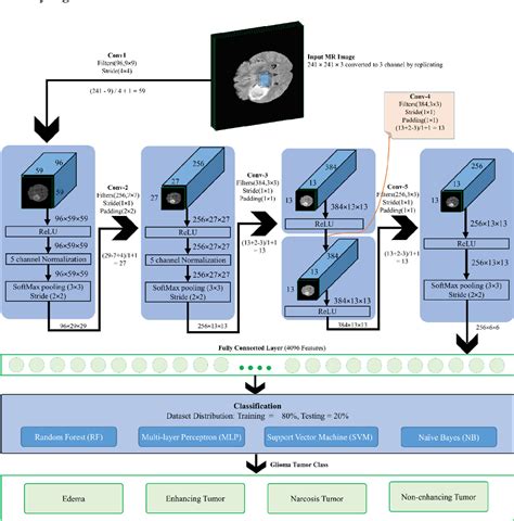 Figure 1 From Glioma Tumors Classification Using Deep Neural Network