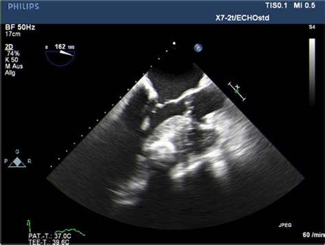 Jacc Case Reports Vol 30 No 7