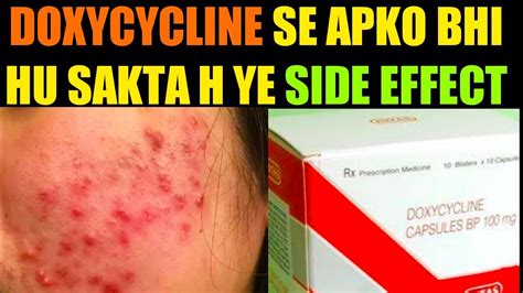 Doxycycline Capsules Ip 100mg In Hindi Doxylab Capsules Uses In Hindi Doxycycline For Acne