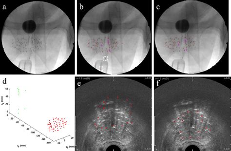 Images Along The Image Processing Pipeline A Undistorted Fluoroscopy Download Scientific