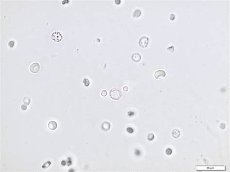 Sedimento Urinário Controllab