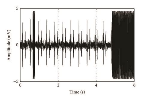 Fetal Heart Rate Detection For An Fpcg Signal A A Low Noise Fpcg Download Scientific Diagram