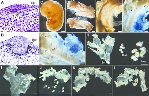 Microdissection Of Ectodermal Appendages From E125 Mouse Embryo Ab